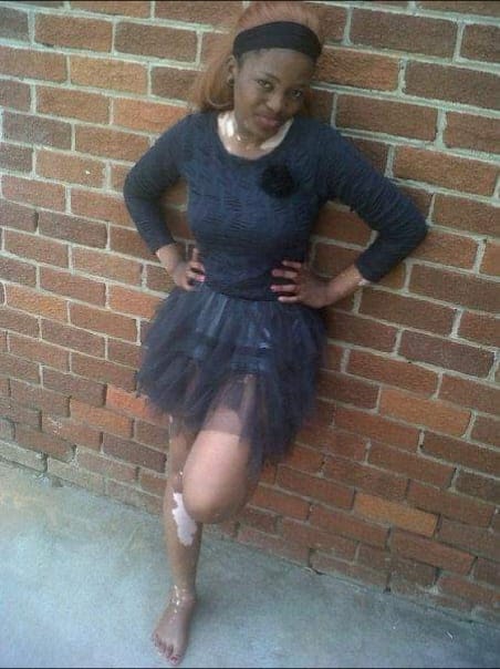 Painful process and rebirth of turning ‘white’